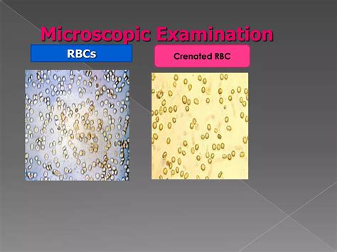 Microscopic Examination Of Urine Pptx