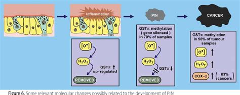 Figure 6 From The Enigma Of Prostatitis Some Historical Perspectives On The Pathogenesis Of
