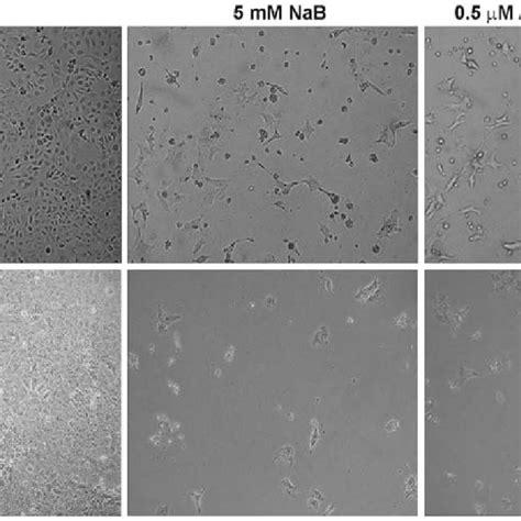 Visual Appearance Of Du145 Cell Line After Treatment With 5 Mm Nab And
