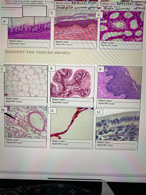 Answered Identify The Tissues Shown Bartleby