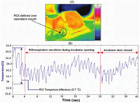 Neonatal Infrared Thermography Imaging A Inside Neonatal Incubator Download Scientific