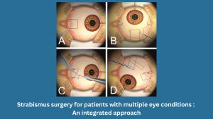 Ophthalmologist In Canberra And Cataract Surgeon Dr Parth Shah