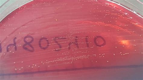 Enterococcus Gallinarum Introduction Morphology Pathogenicity Lab