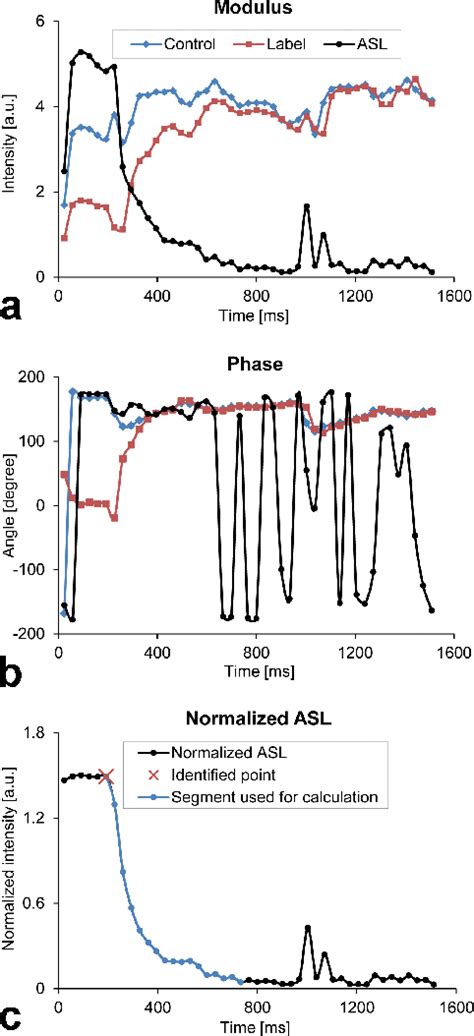 Figure 3 From Measuring The Labeling Efficiency Of Pseudo Continuous Arterial Spin Labeling