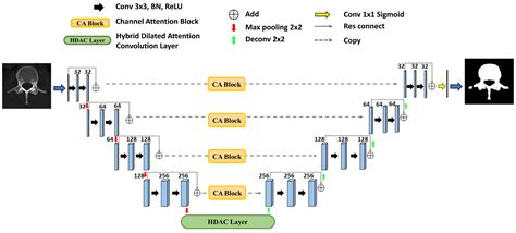 Identification Of Vertebrae In Ct Scans For Improved Clinical Outcomes