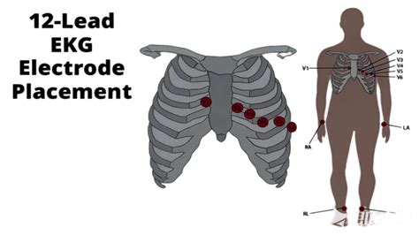 12 Lead Ecg Placement Female How To Position Leads On Women Patients