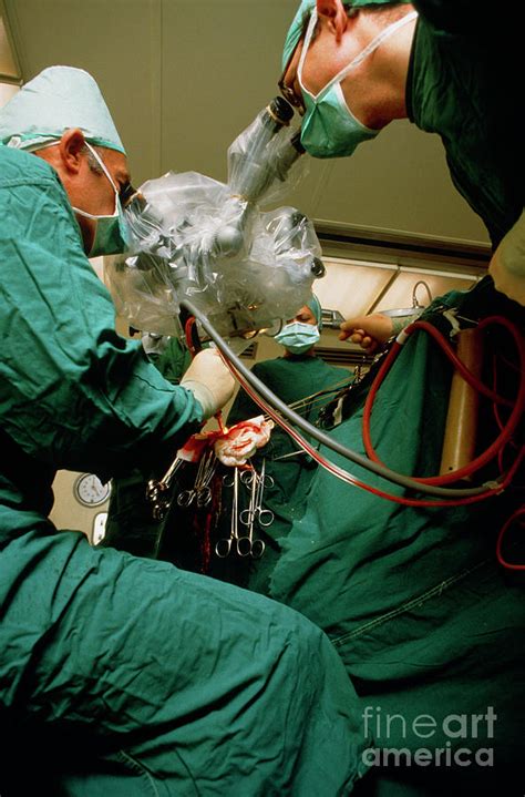 Split Beam Operating Microscope Used In Surgery Photograph By Martin