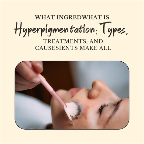 What Is Hyperpigmentation Types Treatments And Causes