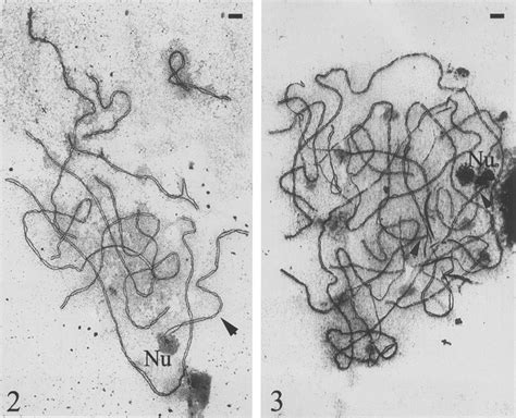 Electron Micrographs Of Silver Stained Pachytene Nuclei Of Two Species Download Scientific