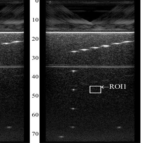 The B Mode Images Using Linear Probe Reconstructed By A The CON Download Scientific Diagram