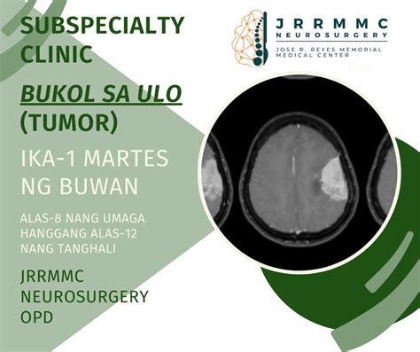 Subspecialty Clinic What Bukol Sa Ulo Tumor When Every 1st Tuesday Of The Month 8 00 Am To