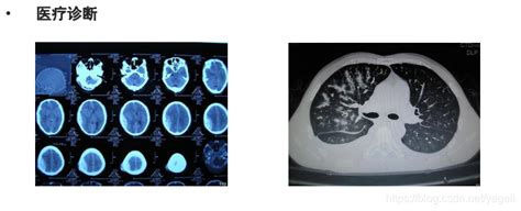深度学习 07图像分类、常用数据集、利用cnn实现图像分类、图像分类优化cnn图像分类算法实现 Csdn博客