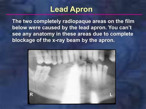 Panoramic Techique Errors Pptx