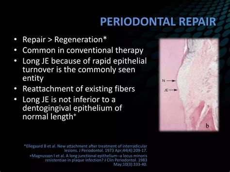 Periodontal Regeneration Ppt