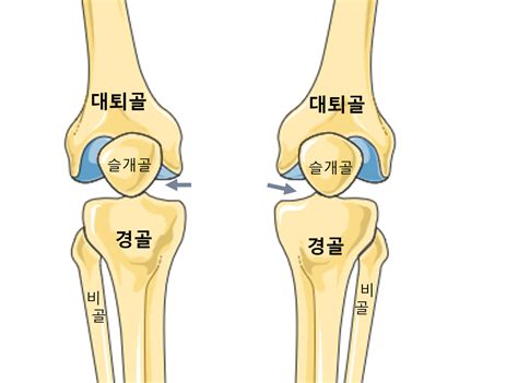 관절 클리닉 무릎 마디세움 정형외과 의원 원주기업도시 대표 정형외과