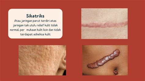 Ppt Macroscopic Structure Of Skin Rash Pdf