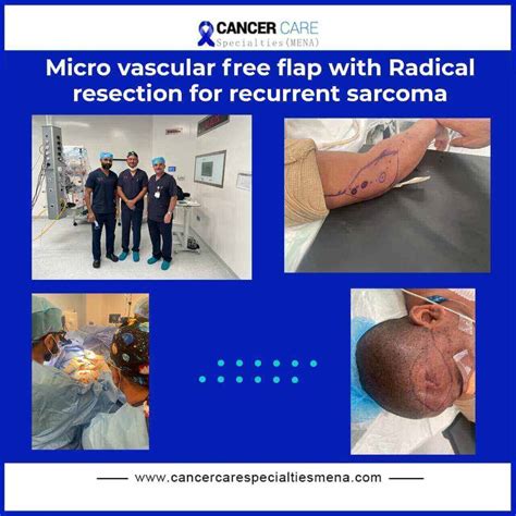 Micro Vascular Free Flap With Radical Resection For Recurrent Sarcoma Cancer Care Center Uae