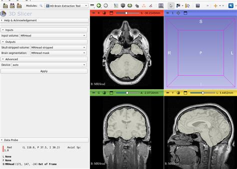 快准狠！在3d Slicer中，使用totalsegmentator扩展可在1分钟内自动分割全身117个器官 Csdn博客