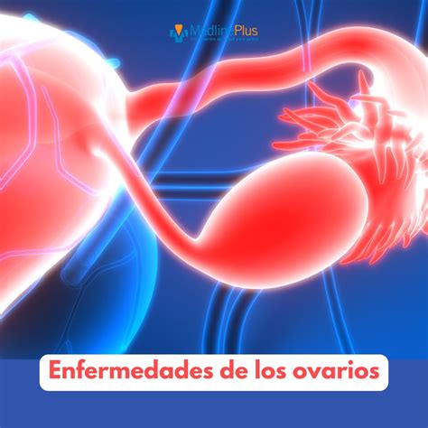Medlineplus ¿cuáles Son Los Tipos De Trastornos De Los Ovarios