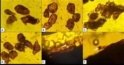 Callus Cells A D And Leaf Cross Sections E F Of Showing Positive