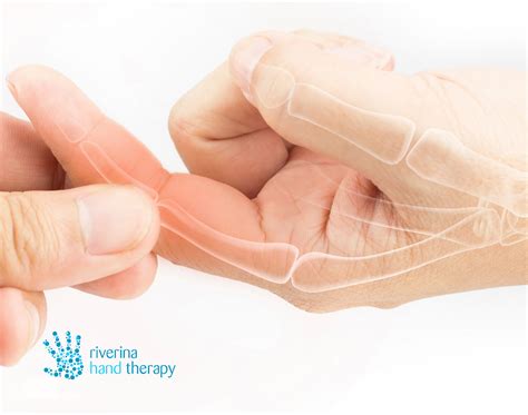 How To Manage A Finger Dislocation During Your Game