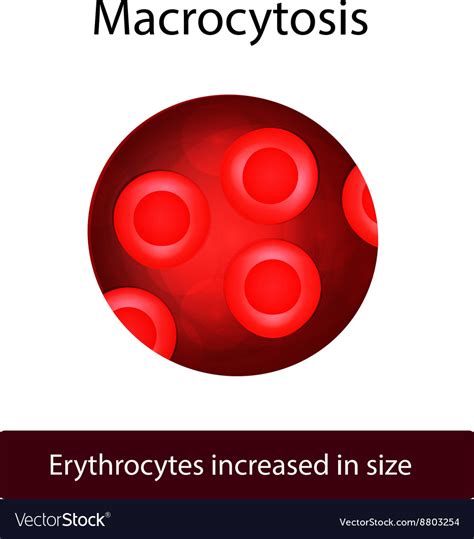 Macrocytes Red Blood Cells Are Increased In Size Vector Image