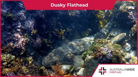 First Aid For Dusky Flathead Sting
