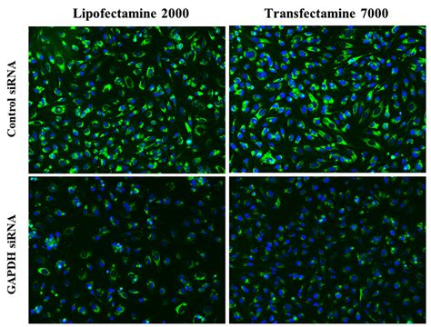 Transfectamine™ 7000 Sirna Transfection Reagent Aat Bioquest