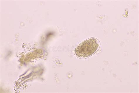 Egg Of Hookworm In Human Stool Stock Image Image Of Analyzing Nematode 201996485