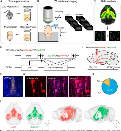 Figure 1 From Dissection Of The Long Range Projections Of Specific Neurons At The Synaptic Level