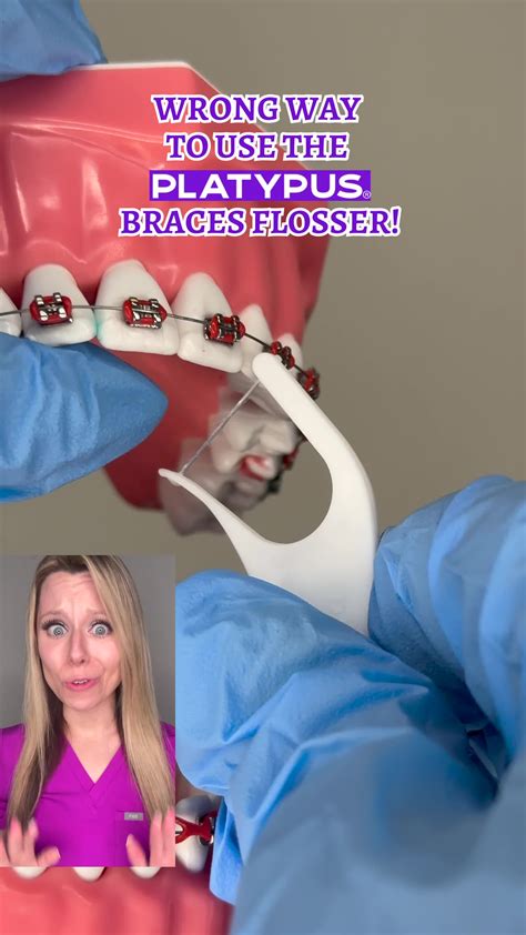How To Use Platypus Braces Flosser Correctly Tiktok