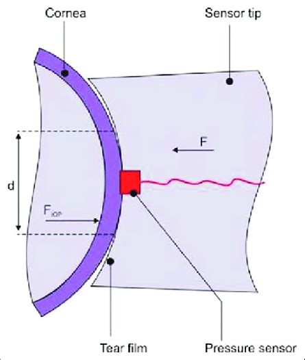 Contour Matching Principle Of Dynamic Contour Tonometer Download Scientific Diagram