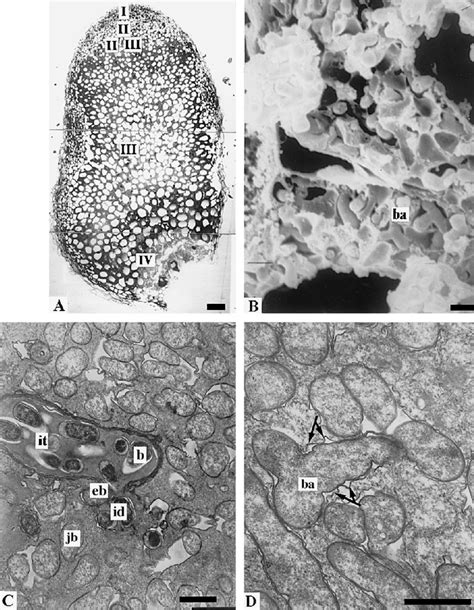 A±d Nodule Morphology And Bacteroid Ultrastructure In The Wild Type Download Scientific Diagram