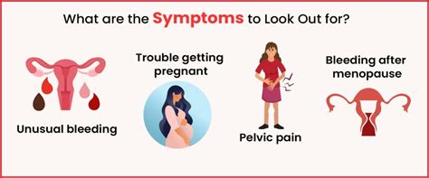 Uterine Polyps Causes Symptoms And Treatment Imprimis Ivf