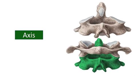 Cervical Vertebrae Anatomy And Pathology Pptx