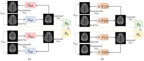 Diagnostics Free Full Text Multi Contrast Mri Image Synthesis Using