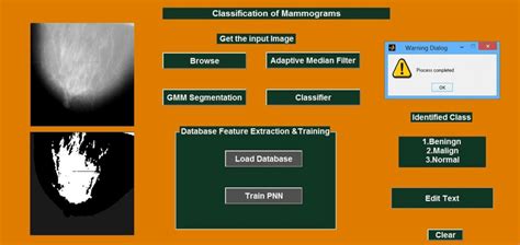 the figure shows the image obtained after performing gmm segmentation