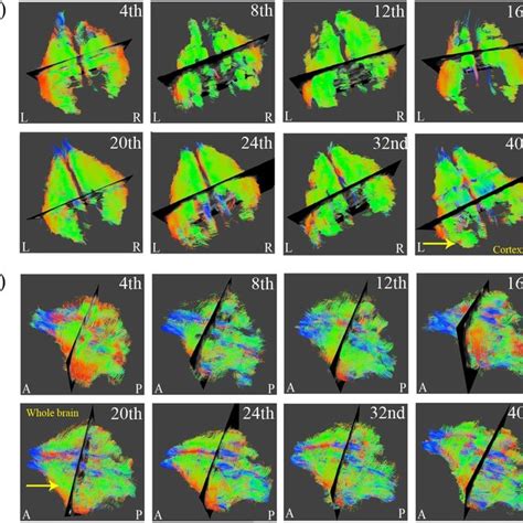 The Dti Tractography Of A Cerebral Cortex And B Whole Brain From 4 Download Scientific