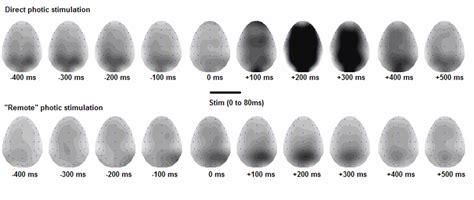 Spatial Distribution Of Evoked Alpha Power During Direct Photic Download Scientific Diagram