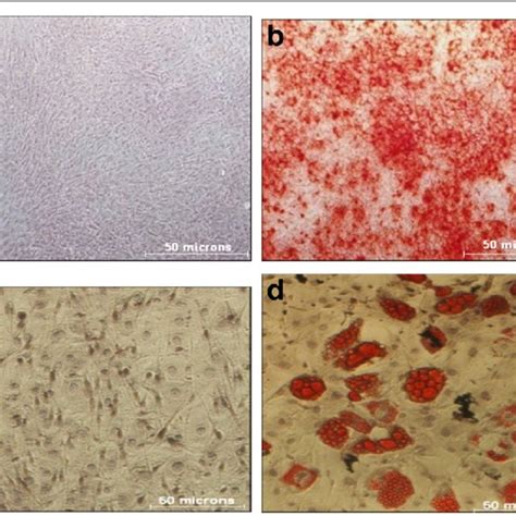 Intracellular Staining For Insulin Three Columns Show Insulin Staining