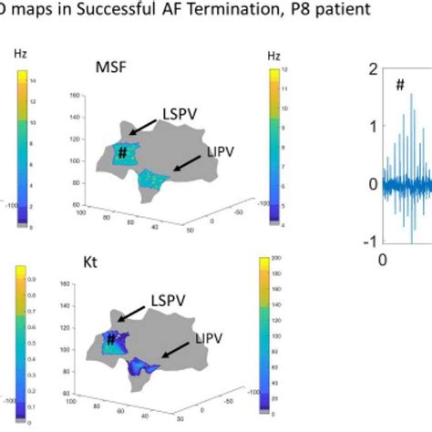The Three Dimensional 3d Visualization Of The Individual Approaches
