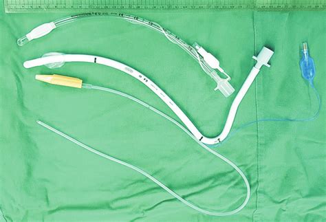 Facial Computed Tomography Showing No Definitive Abnormal Finding Such Download Scientific