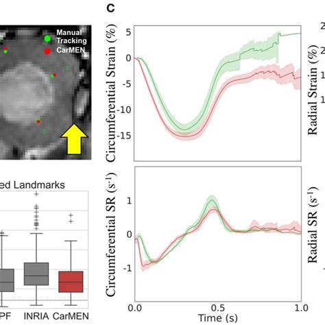 Validation Of Motion And Strain Using The Cmac Dataset A Landmarks Download Scientific