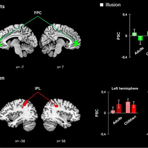 Activation Cluster In The Frontopolar Cortex Revealed By The Contrast