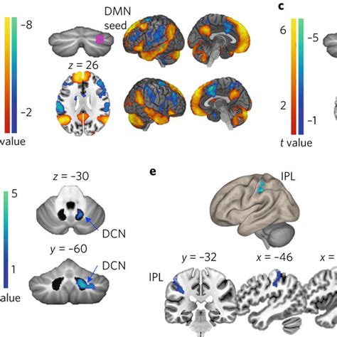 Fc And Bold Activation Before And During Tdcs Administration In