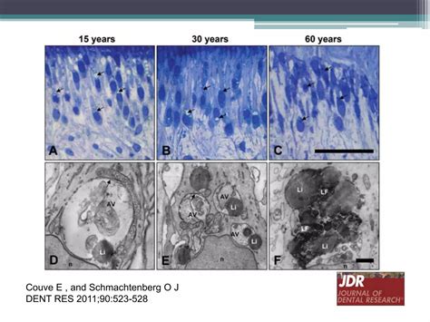 Histology Of Pulp Pptx Dental Health Diseases And Conditions