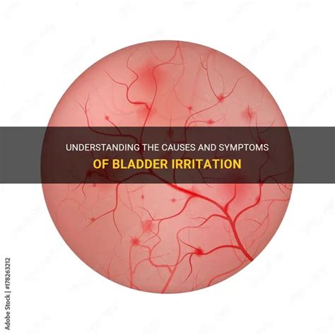 Understanding The Causes And Symptoms Of Bladder Irritation Medshun