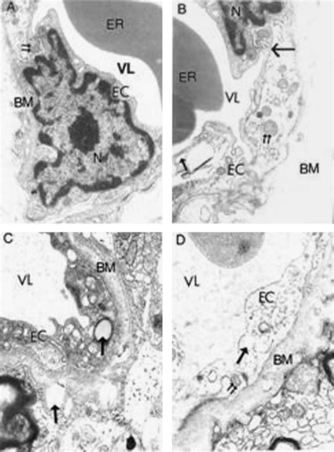 The Ultrastructural Characteristics Of Brain Microvessels From Ad Download Scientific Diagram