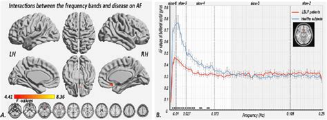 Interactions Between The Five Specific Frequency Bands And Disease Download Scientific Diagram