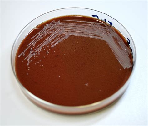 Free Picture Colonial Morphology Exhibited Colonies Brucella Abortus Bacteria